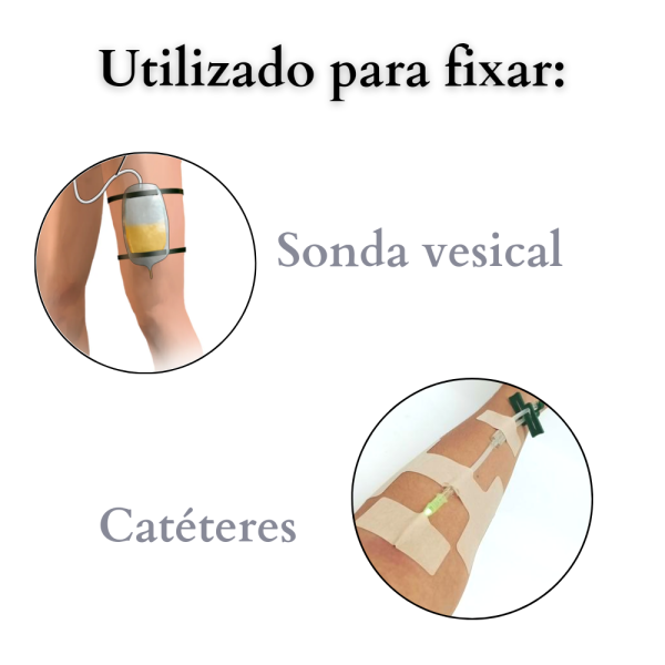 FIXADOR PARA CATETER E SONDA VESICAL C/10 – HELPFIX – Unic Digital
